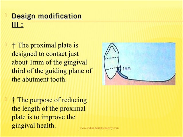 Concepts of rpi / dental implant courses by Indian dental academy ...