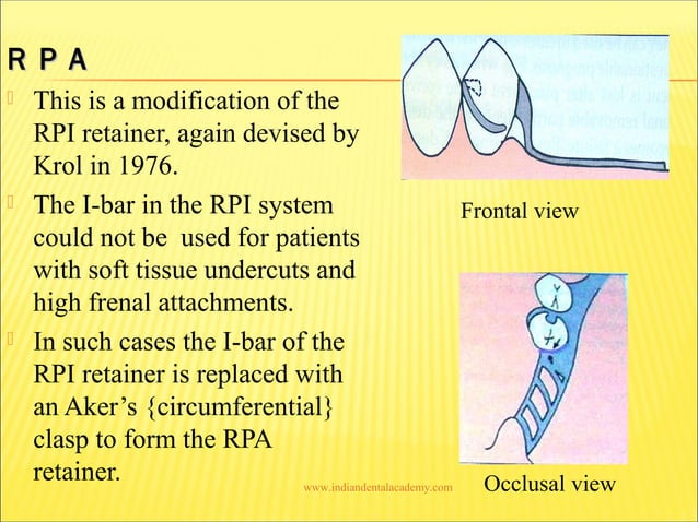 Concepts of rpi / dental implant courses by Indian dental academy