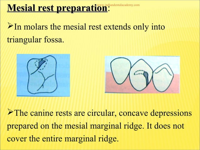 Concepts of rpi / dental implant courses by Indian dental academy ...