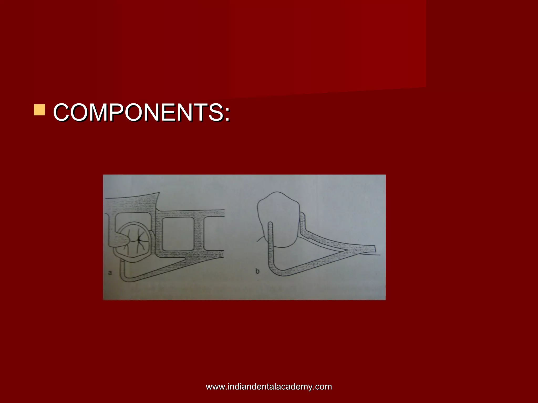 Concepts of rpi and indirect retainers copy | PPT