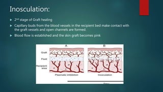 Concepts of Skin Grafts and skin substitutes.pptx