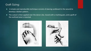 Concepts of Skin Grafts and skin substitutes.pptx