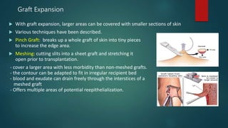 Concepts of Skin Grafts and skin substitutes.pptx