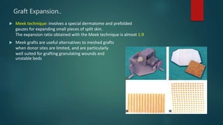 Concepts of Skin Grafts and skin substitutes.pptx