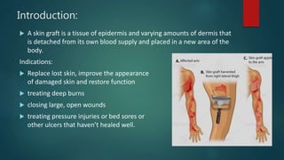 Concepts of Skin Grafts and skin substitutes.pptx