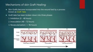 Concepts of Skin Grafts and skin substitutes.pptx