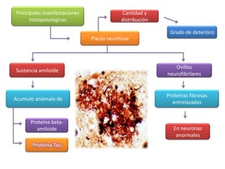 Alzhaimer | PPTX