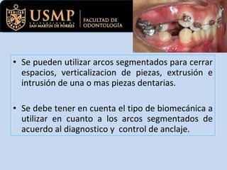 Conclusiones arco segmentado | PPT