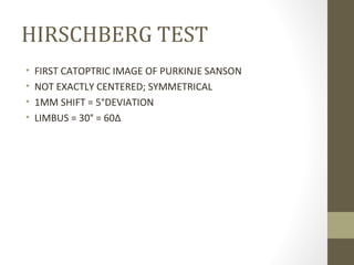 Squint examination & management- simplified !! | PPT