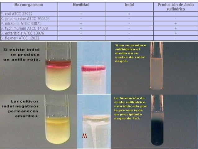 PruebasBioquimicas de Identificacion de Enterobacterias