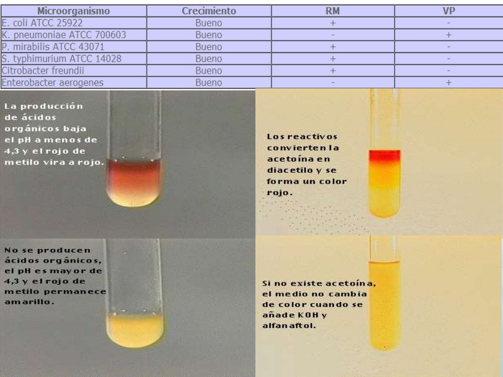 PruebasBioquimicas de Identificacion de Enterobacterias
