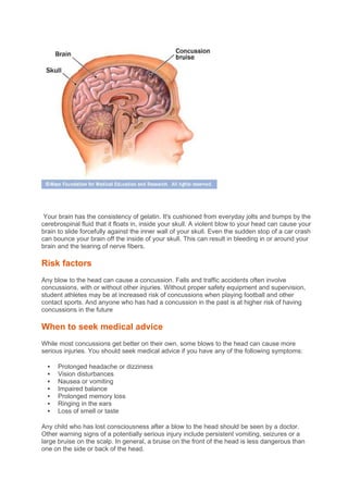 Concussion | DOC