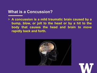Concussion - 1.pptx