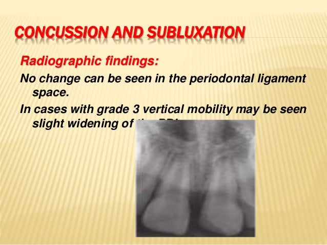 Concussion and subluxation