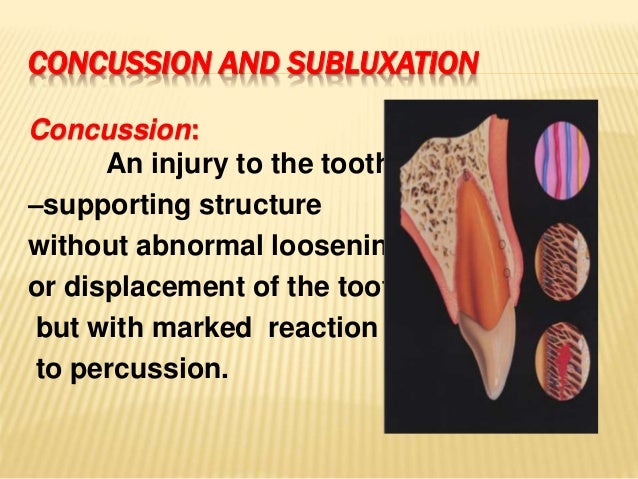 Concussion and subluxation