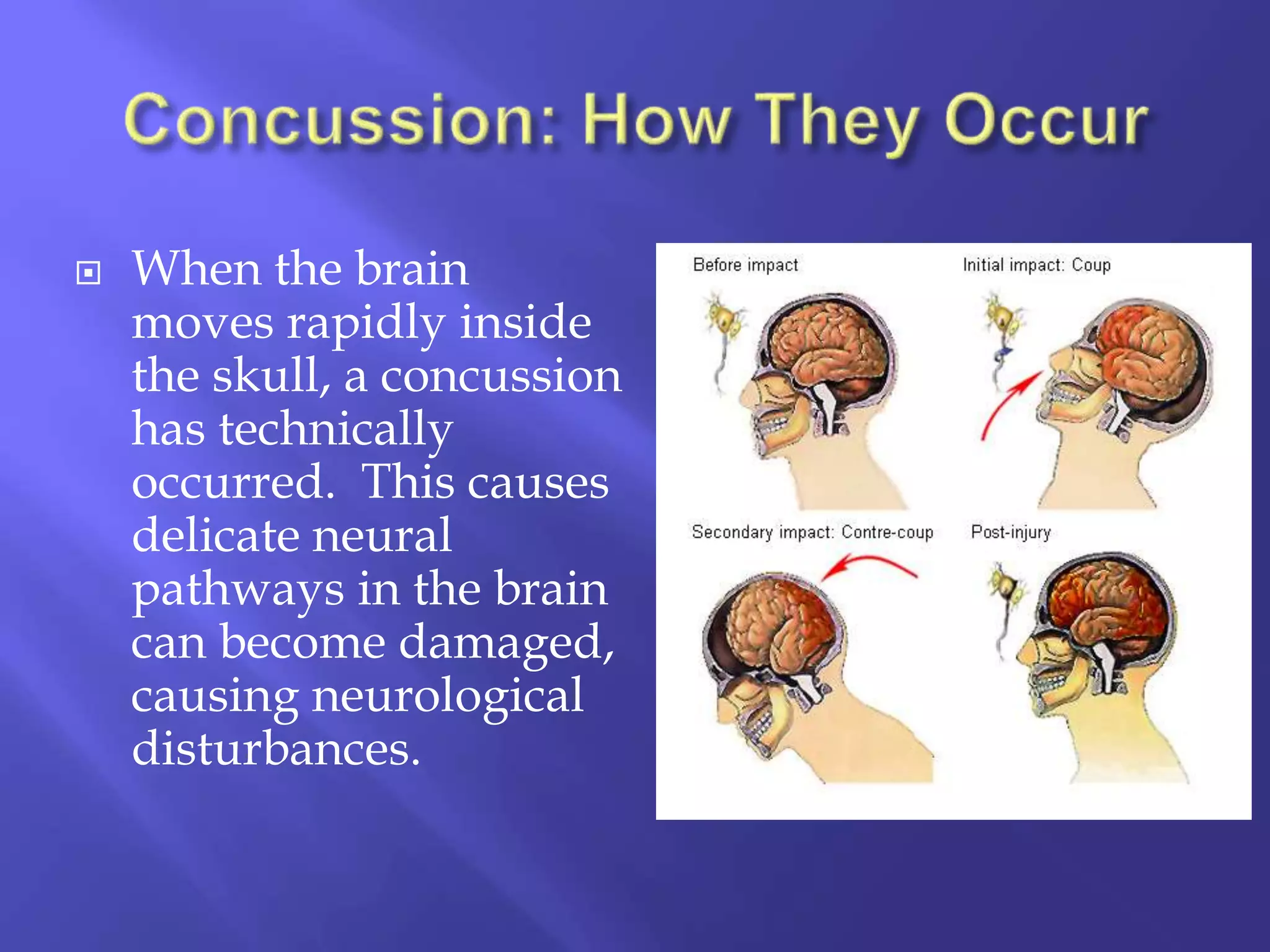 Concussion and your athlete | PPTX | Death, Injury, or Military ...