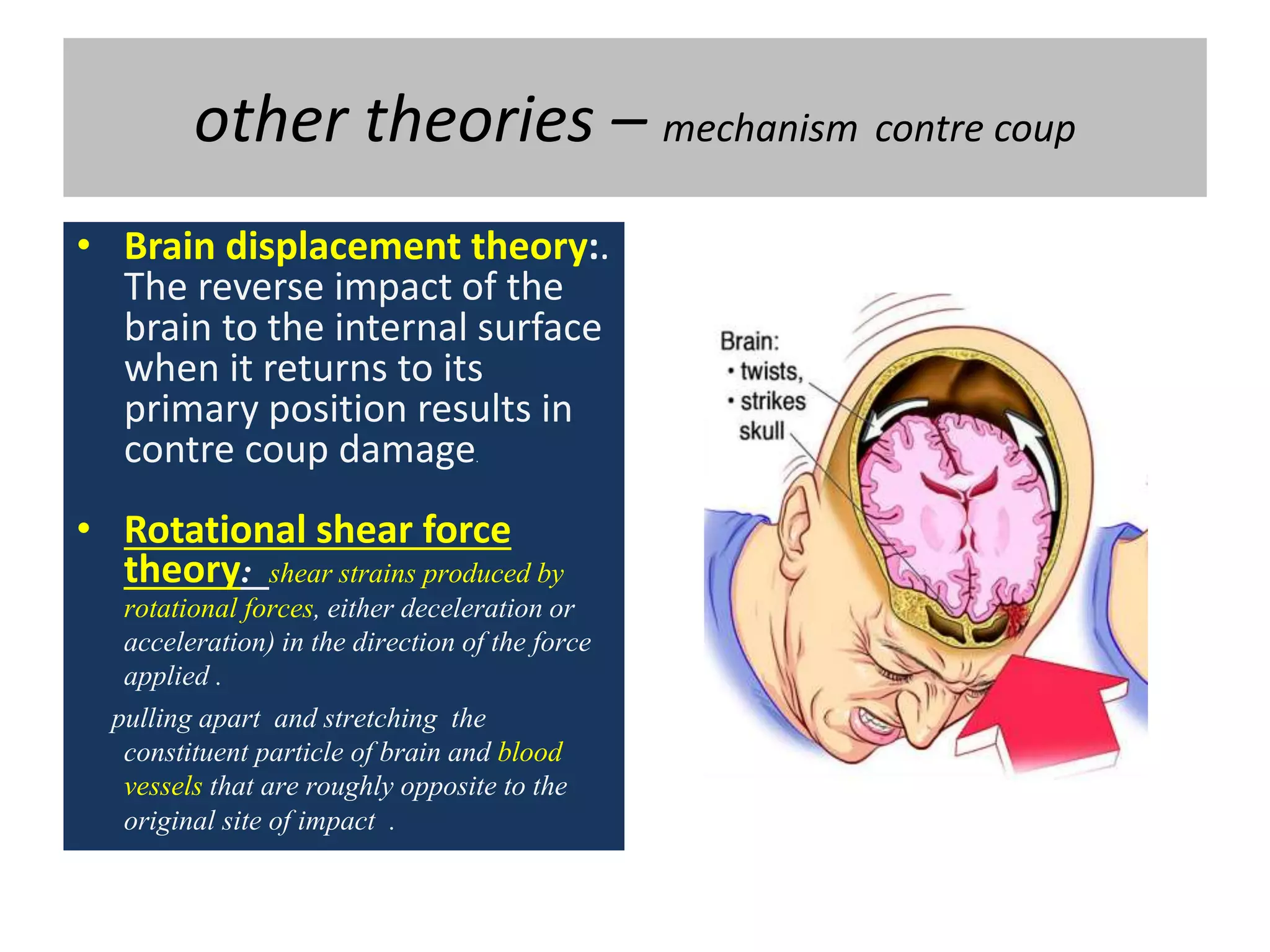 contre coup injury,Concussion,DAI, EDH- forensic aspects | PPT