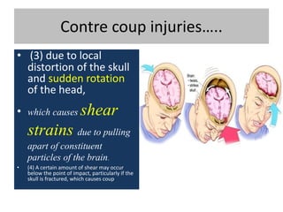 contre coup injury,Concussion,DAI, EDH- forensic aspects | PPTX