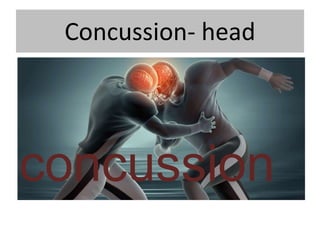 contre coup injury,Concussion,DAI, EDH- forensic aspects | PPTX