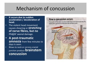 contre coup injury,Concussion,DAI, EDH- forensic aspects | PPTX