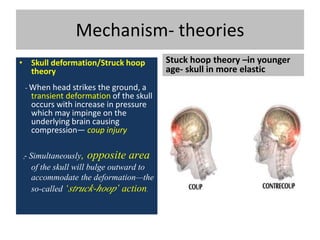 Contrecoup Fracture