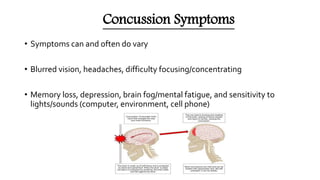 Concussions and Their Impact | PPTX | Death, Injury, or Military Conflict | Sensitive Topics
