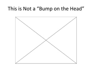 Concussion presentation for gpt dr. popoli’s presentation | PPTX