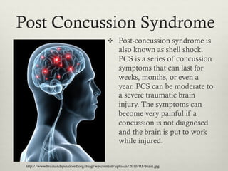 Concussions | PDF