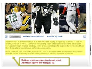 Concussions | PPTX