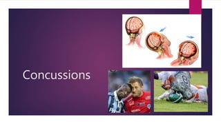 Concussions | PPT
