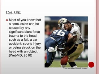 Concussions are Affecting the Game of Football | PPT