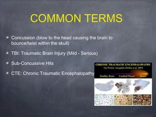 Concussion slideshow | PPT