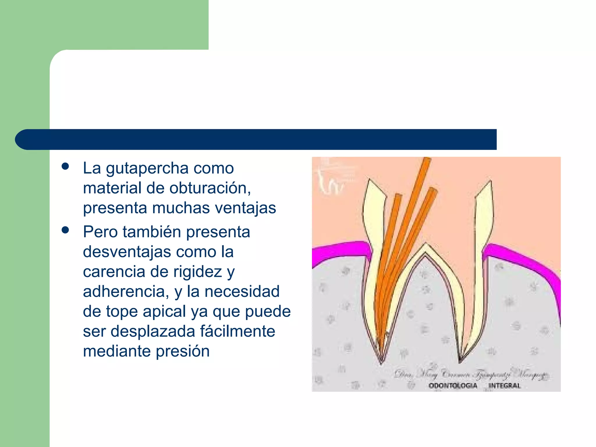 Condensacion lateral de ingle | PPT