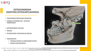 CONDILECTOMIA INTRAORAL TECNICA INTRAORAL COMPILACION | PPTX