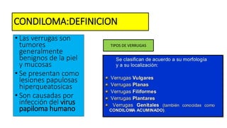 Condiloma acuminado | PPTX
