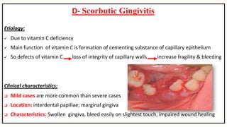 conditioned Gingival diseases - Copy.pdf