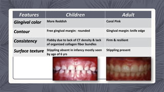 conditioned Gingival diseases - Copy.pdf