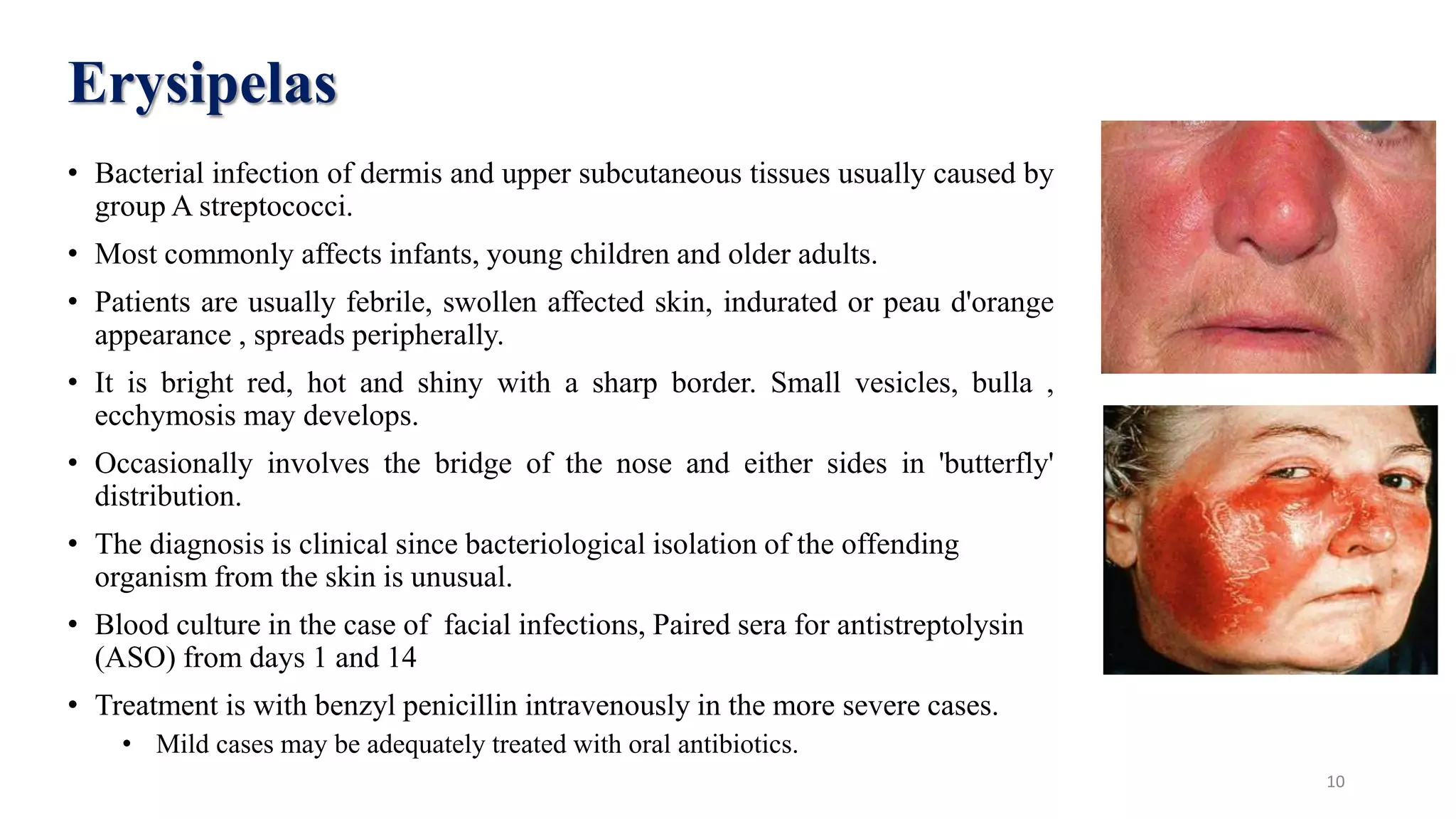 Condition of external nose dr rk | PPTX
