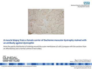 Conditions: Duchenne Muscular Dystrophy XL | PPT