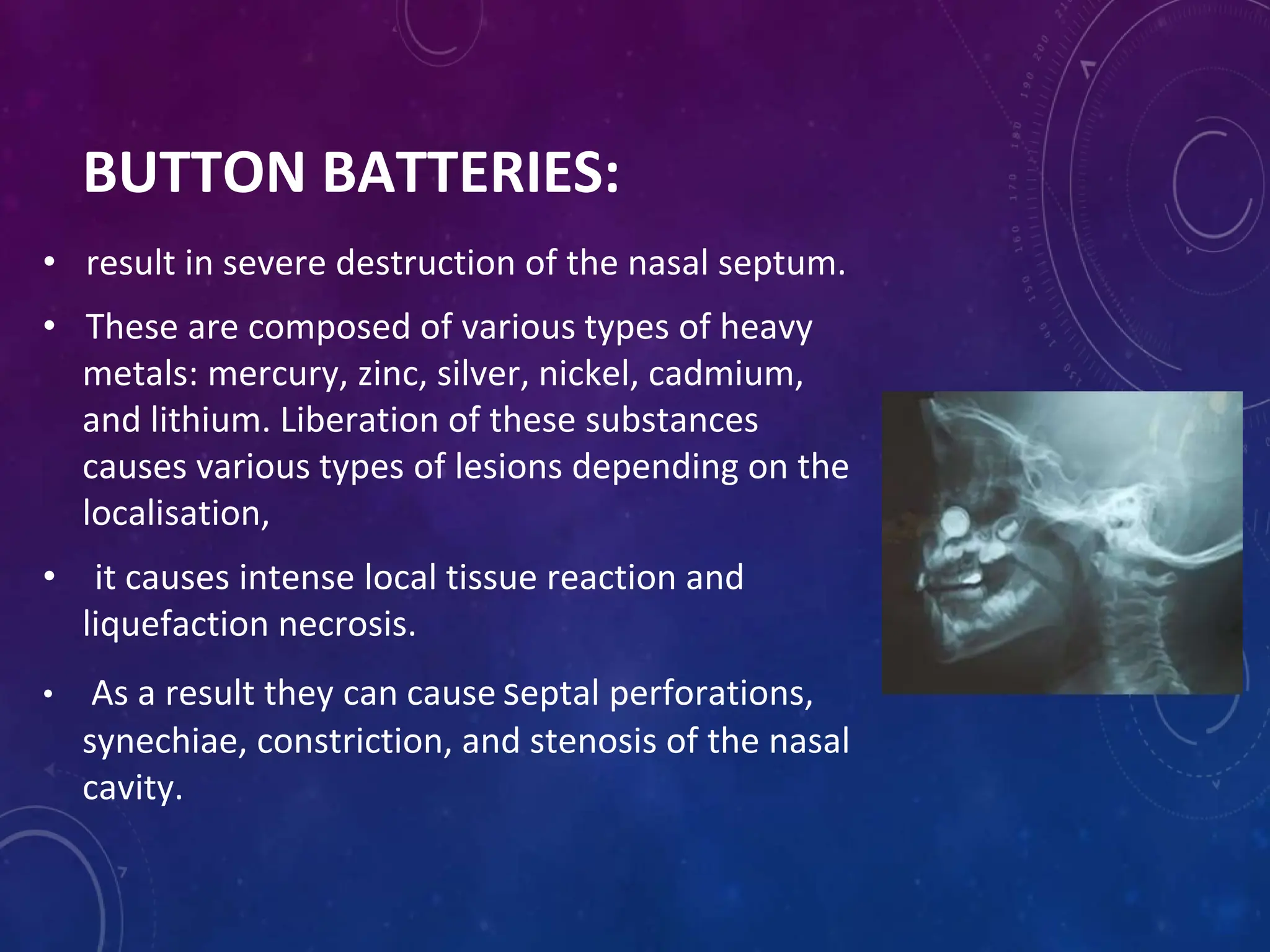 CONDITIONS OF NOSE Bsc Nursing LMMU.pptx | Ear, Nose and Throat Conditions | Diseases and Conditions