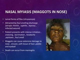 CONDITIONS OF NOSE general ent (1).pptx
