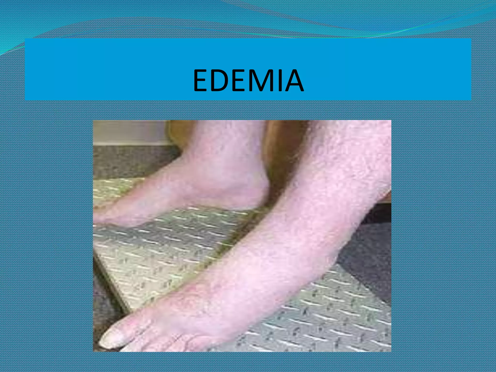 Conditions which encourage skin breakdown in a patient | PPT