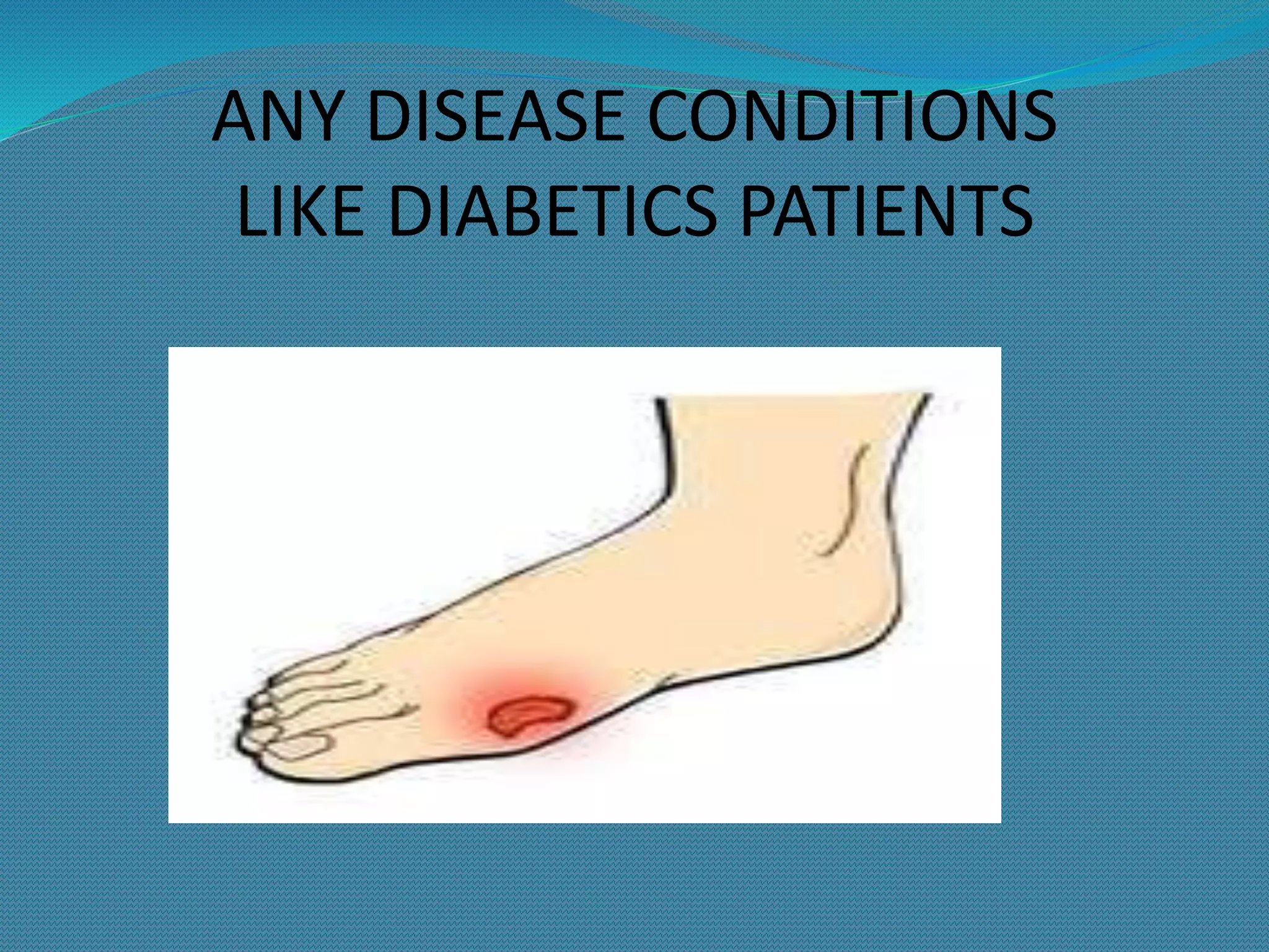 Conditions which encourage skin breakdown in a patient | PPT