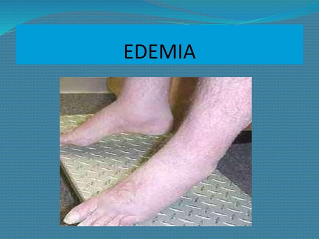 Conditions which encourage skin breakdown in a patient | PPT