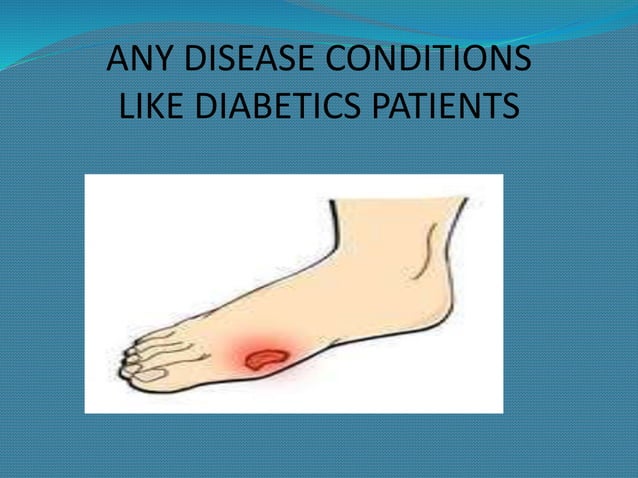 Conditions which encourage skin breakdown in a patient | PPT