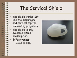 Diaphragm, Cervical Cap, And Cervical Shield