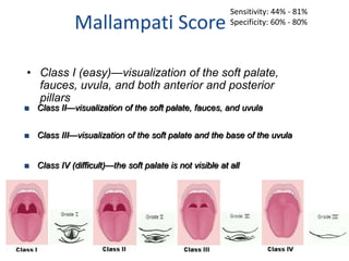 Conduct of general anesthesia | PPTX
