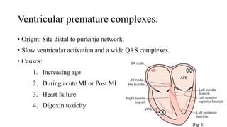 Conducting system of heart and ventricular arrhythmias | PPT