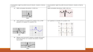 Conduction abnormalities part I | PPTX