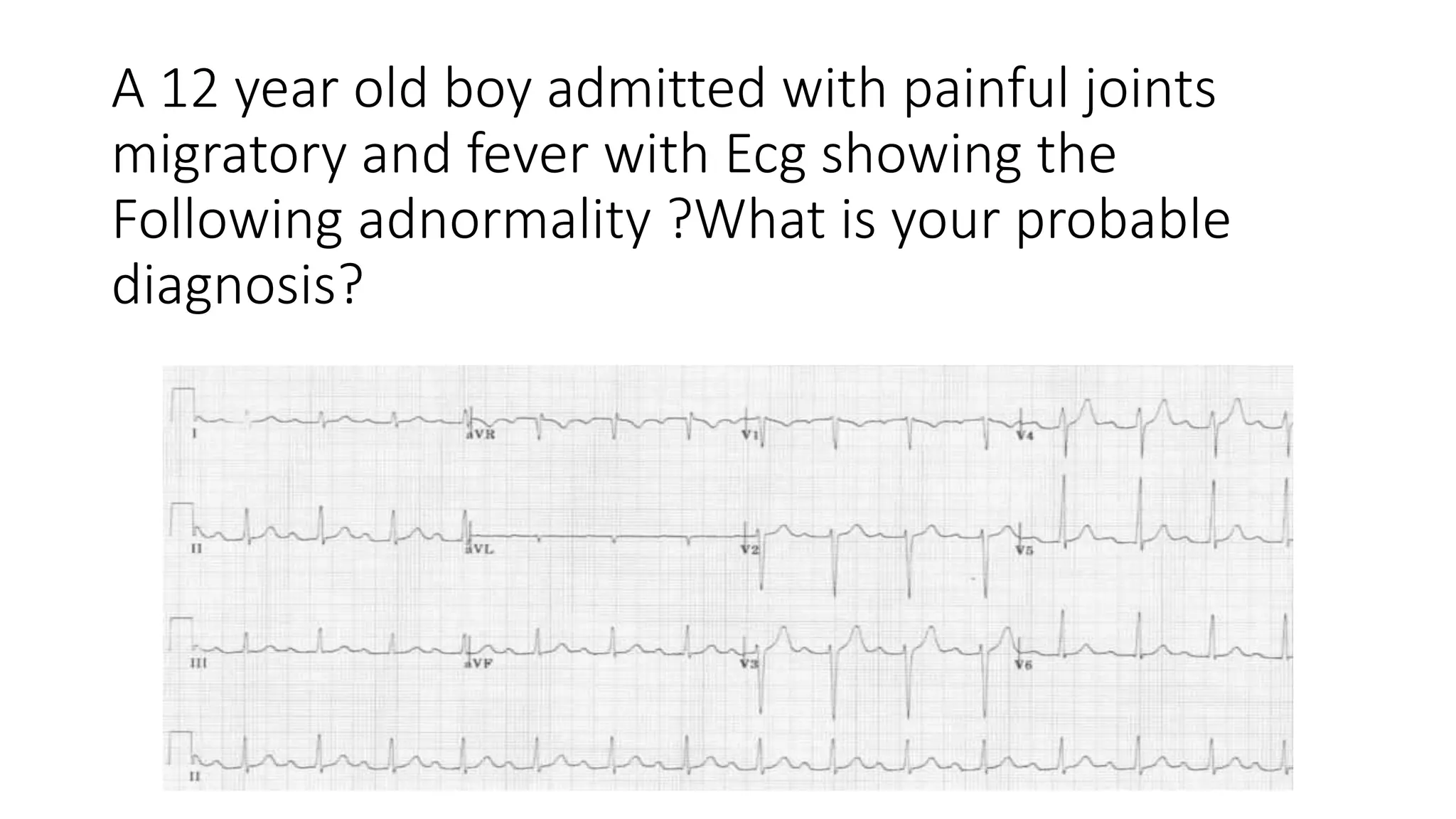 Conduction abnormalities part 2 | PPTX